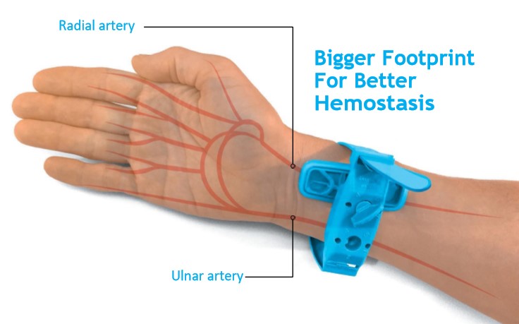 Radial Compression Devices • Mediterra • View the product range