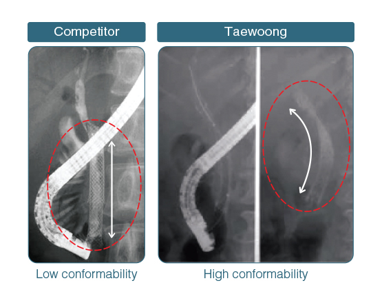 Biliary Stents • Mediterra • View the product range